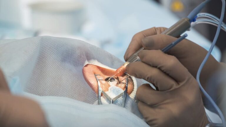 8 Tips for Quick Recovery after Cataract Surgery | WK Eye Institute